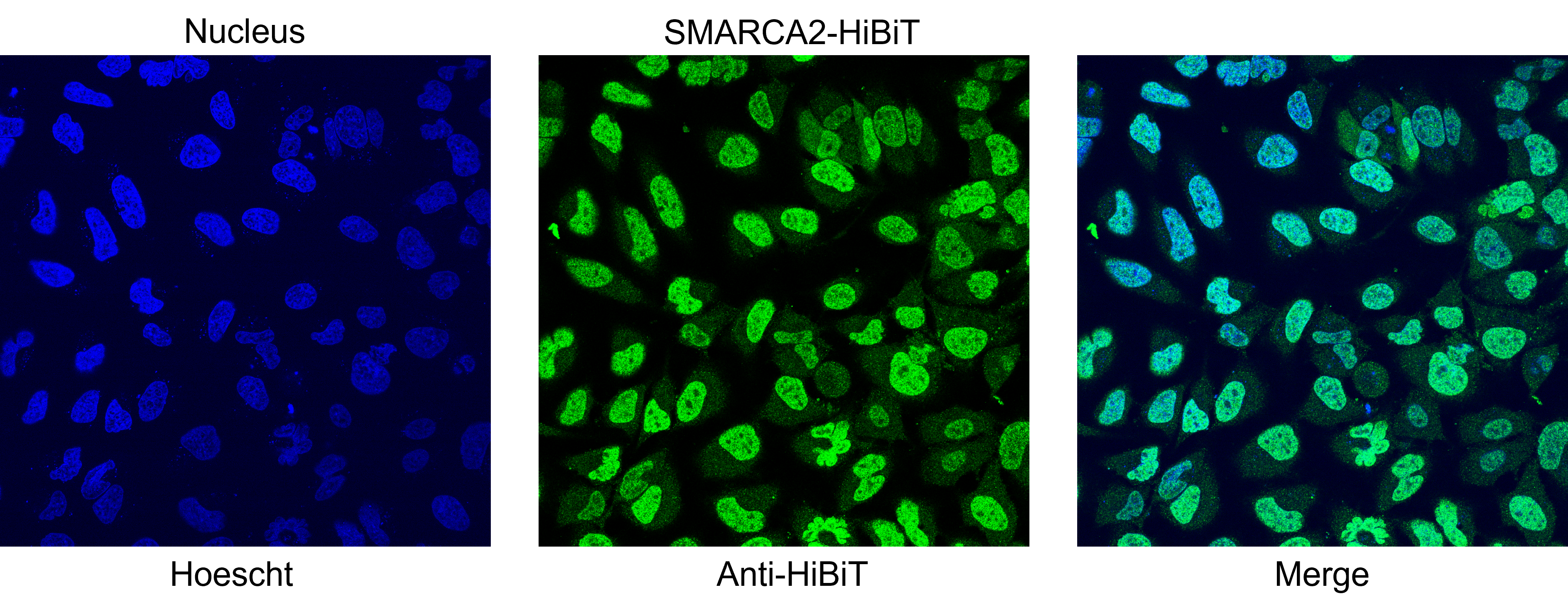 Comprehensive Analysis of Protein Dynamics Using HiBiT Tagging ...